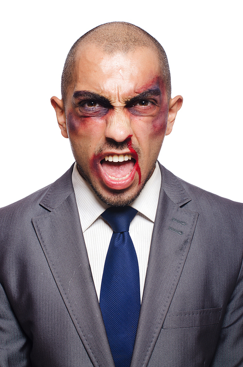 유토이미지 | Badly beaten businessman isolated on white