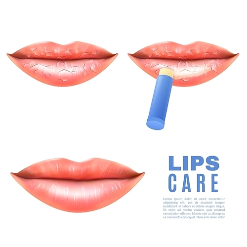 Lip care balsam for moisturizing treatment of chapped dry and sensitive ...