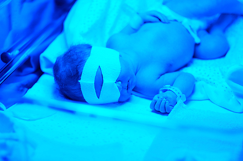 유토이미지 | Two days old newborn baby having photo theraphy under blue UV light