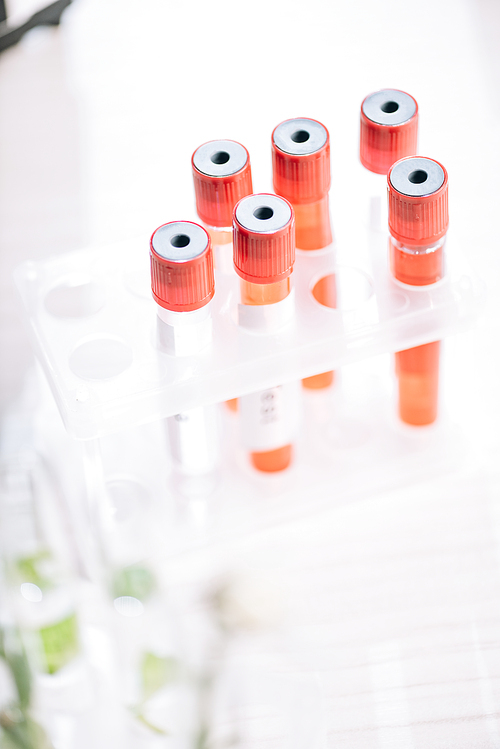 유토이미지 | selective focus of red test tubes with samples