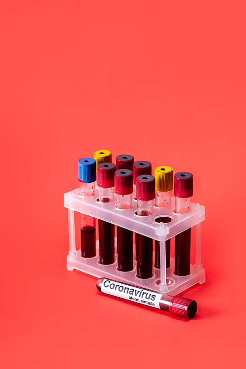 유토이미지 | test tubes with blood samples with coronavirus lettering on red